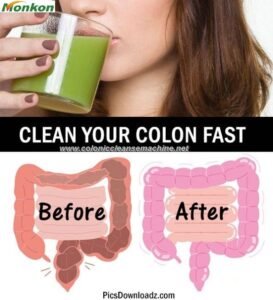 After Colon Hydrotherapy: Expert-Backed Recovery Tips, Side Effects ...