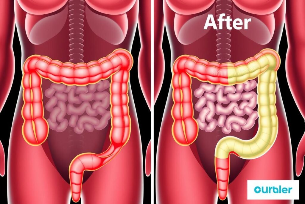 Colonic Irrigation Benefits: Comprehensive Detoxification Guide