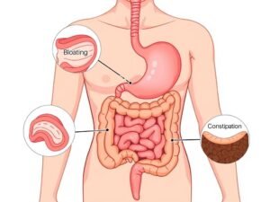 What Colonics? Understanding Colonic Hydrotherapy